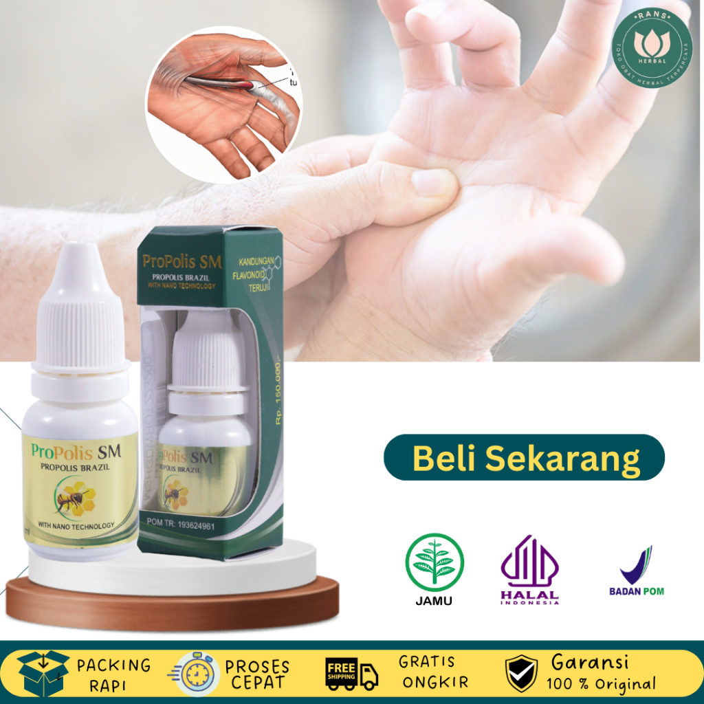 Jual Obat Herbal Jari Pelatuk Trigger Finger Obat Jari Tangan Kaku Susah Di Tekuk Obat Nyeri ...