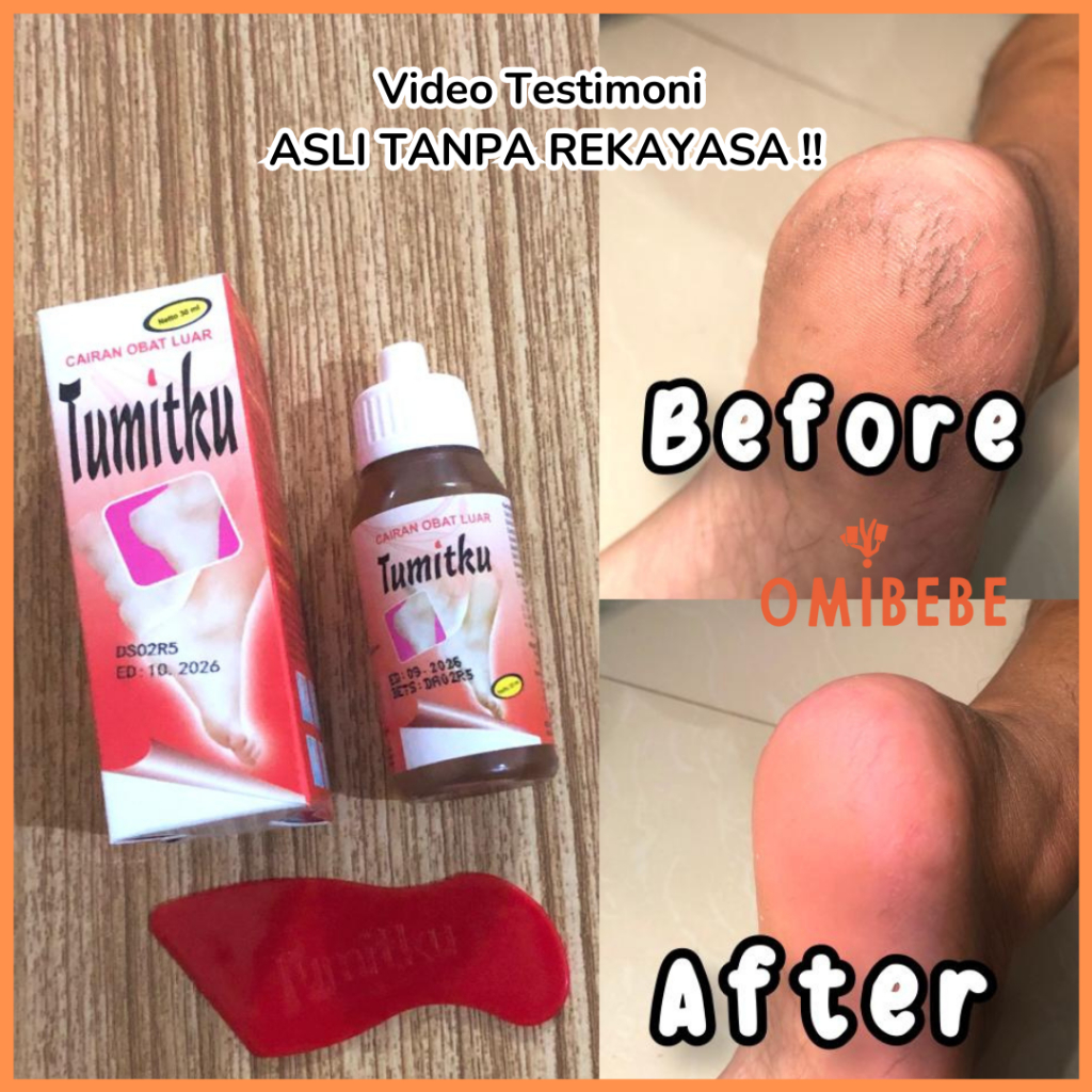 Jual Tumitku Original BPOM 30ml Obat Kaki Kering Dan Pecah Mengatasi ...