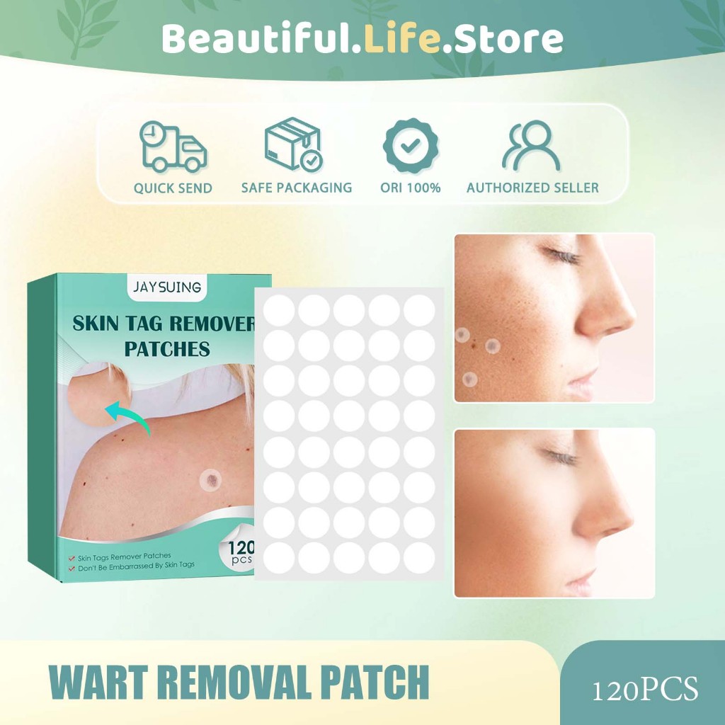 Jual Jaysuing Wart Removal Patch 120pcs Skin Tag Removal Patch Stiker ...