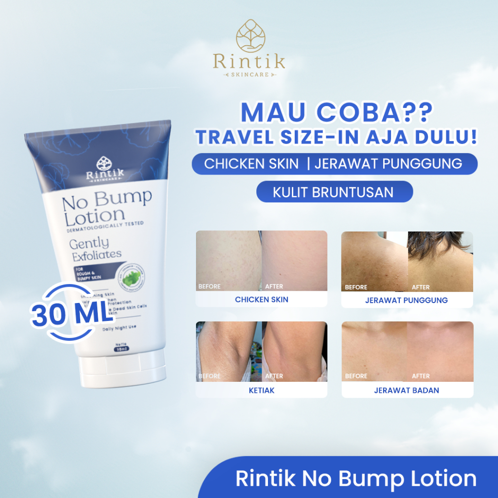 Jual Rintik Skincare - Travel Size No Bump Lotion/Lotion Tubuh Kulit ...