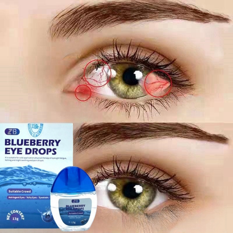 Jual Obat Tetes Mata Obat Mata Minus Obat Mata Katarak 15ml Mata kering ...