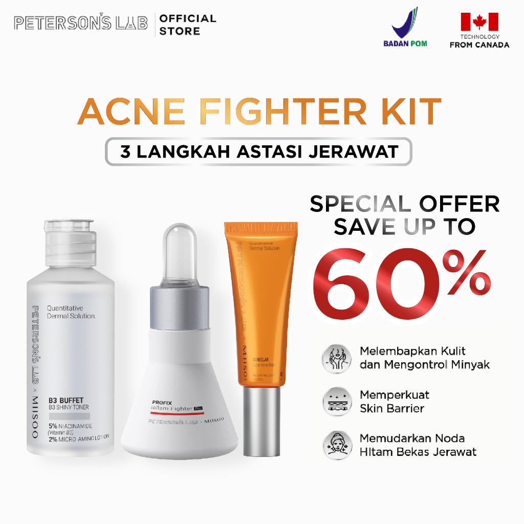Jual Peterson's Lab - Acne Fighter Kit Bundle (Shiny Toner + Profix Inflam Fighter + Super Acne ...