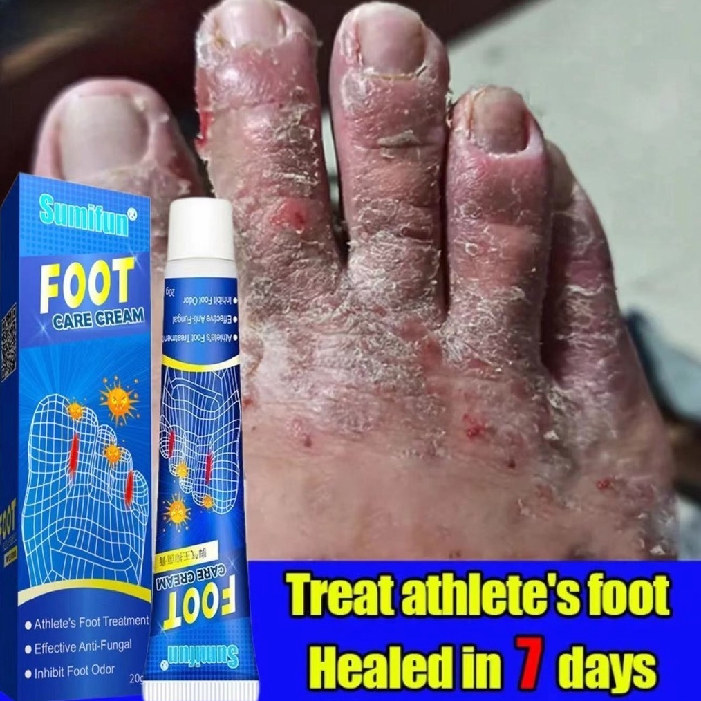 Jual Sumilfun Foot Cream Foot Antifungal Ointment Natural Foot Cream ...