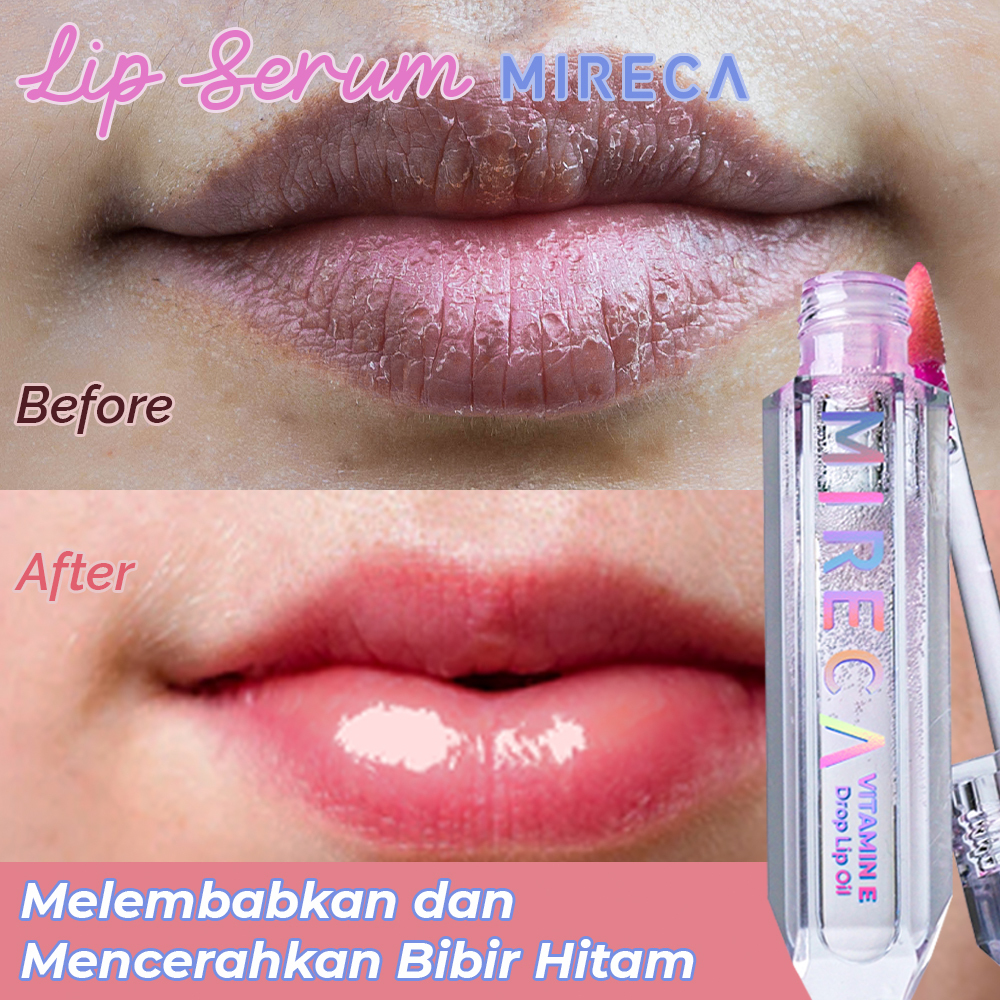 Jual Lip Serum mencerahkan bibir hitam dan melembab kan bibir | pencerah bibir hitam | Shopee ...