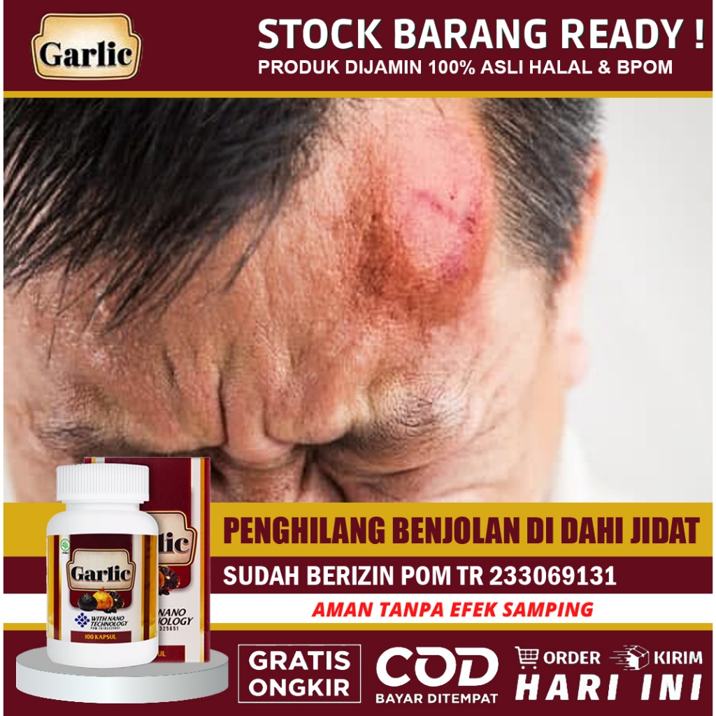 Jual Obat Benjolan di Dahi, Obat Penghilang Benjolan di Jidat ...
