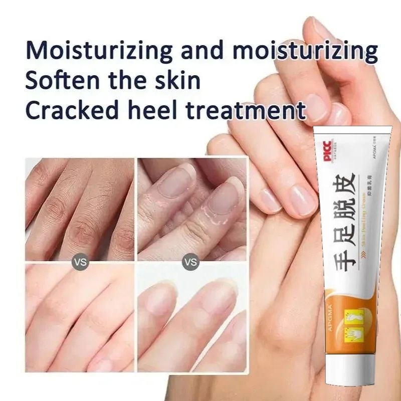 Jual Salep PICC Penghalus Tumit Kaki Obat Kaki Pecah Pecah dan Kering ...
