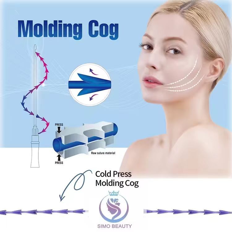 Jual Minerva Benang Pipi Thread Lift 18g*100mm PDO/PCL fishbone/molding ...