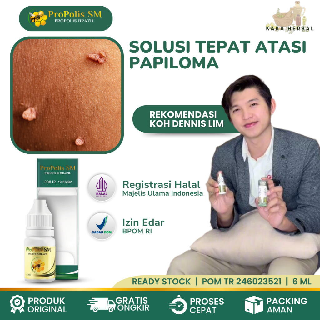 Jual Obat Penghilang Kutil di Leher Papiloma Skin Tag Daging Tumbuh ...