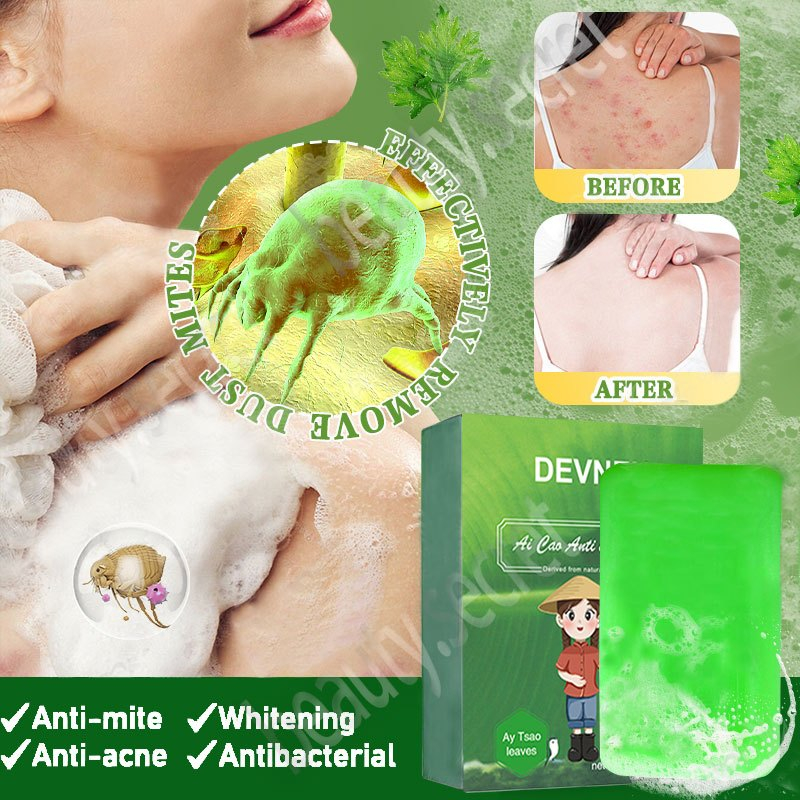 Jual Sabun Mandi Gatal 85g Herble Soap Eczema Treatment Anti Itching ...
