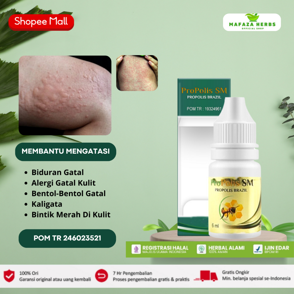 Jual Obat Biduran Alergi Dingin Bentol Kulit Kaligata Biang Keringat ...