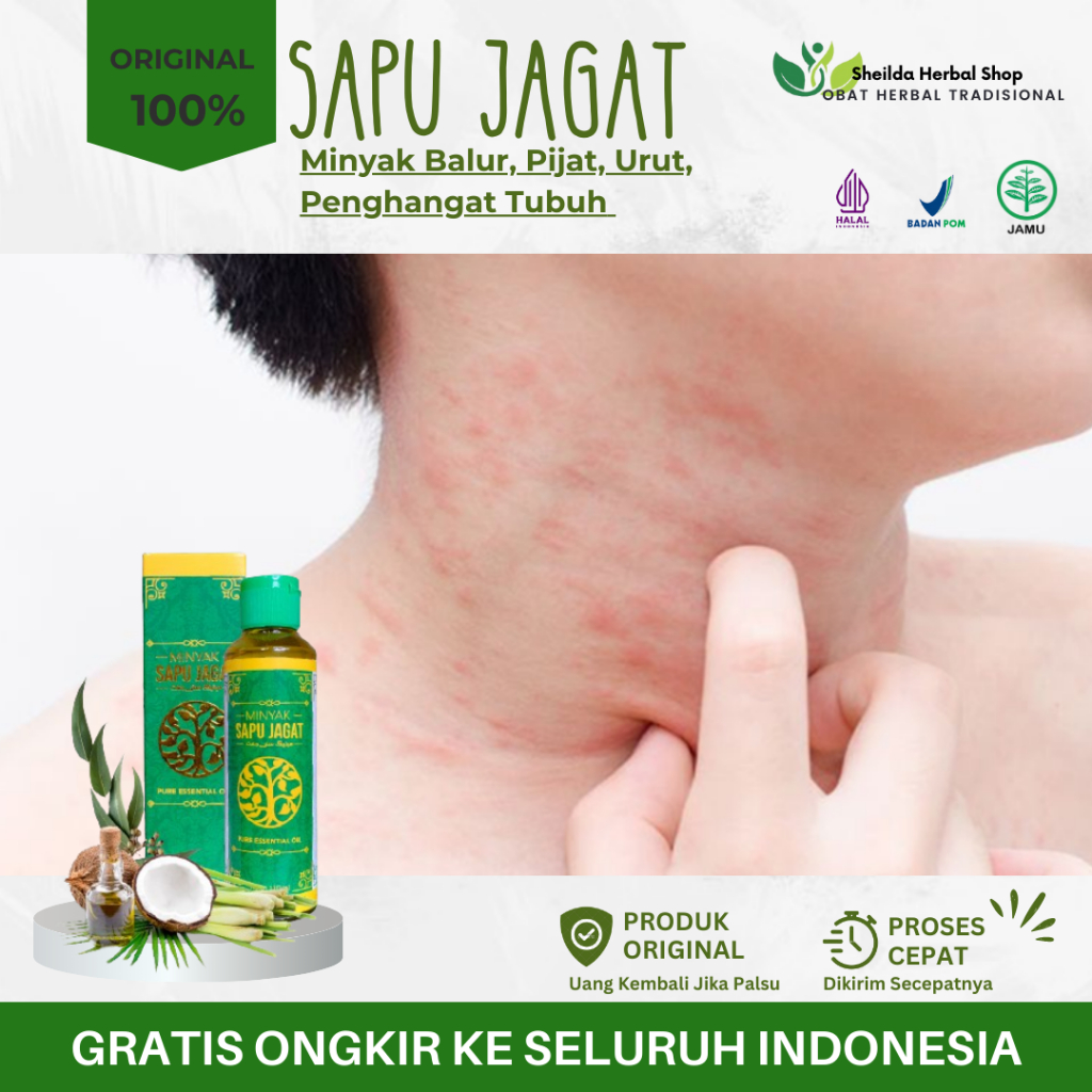 Jual Minyak Balur Kaligata, Gatal Biduran, Bentol Ruam Kemerahan ...