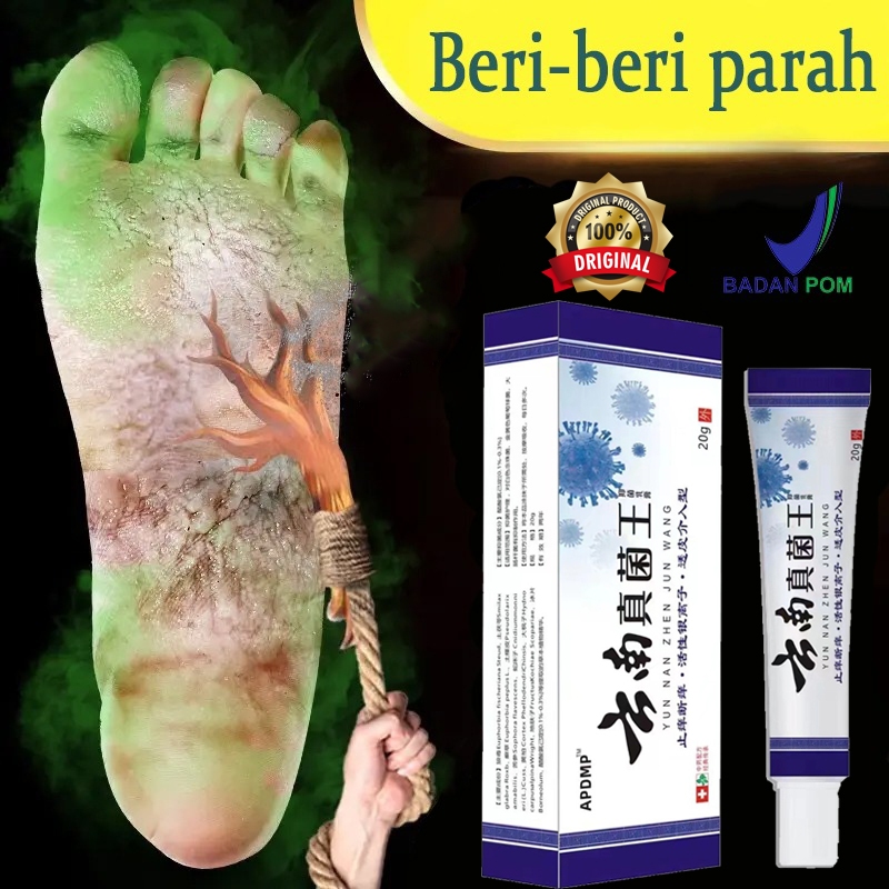 Jual Penghilang bau kaki Obat jamur kaki Foot salep 20g Anti-gatal ...