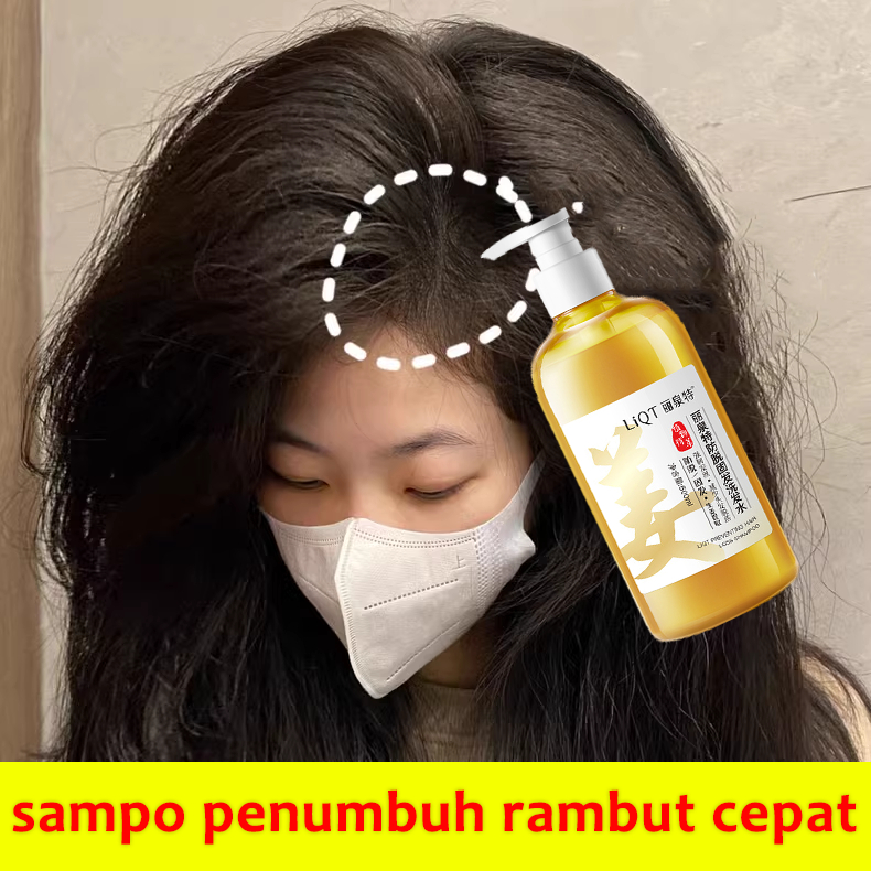 Jual sampo penumbuh rambut cepat perawatan rambut rontok Shampo rambut ...