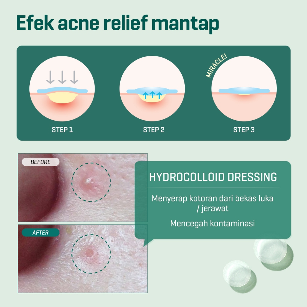 Jual SOME BY MI 30 Days Miracle Clear Spot Patch / Pimple Patch ...