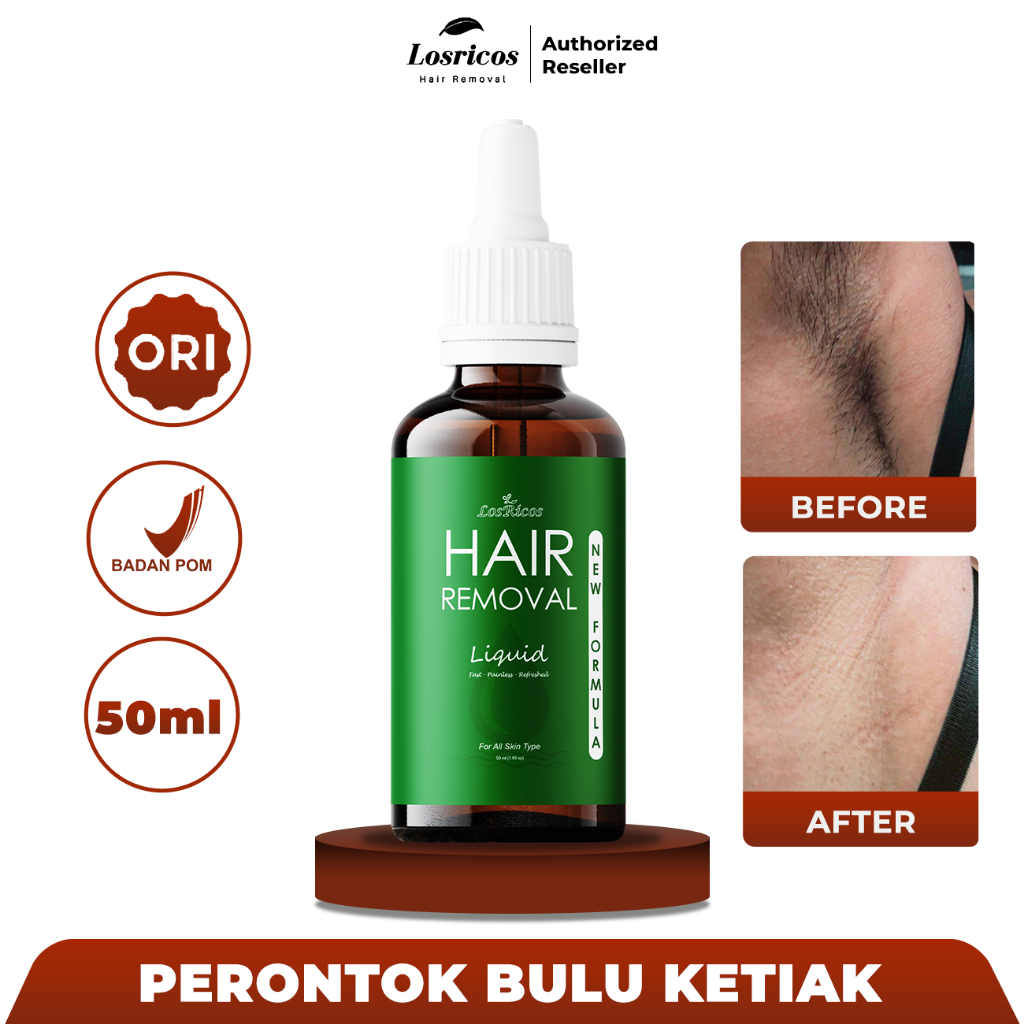 Jual Losricos Perontok Bulu Ketiak dan Kemaluan Permanen Hair Removal ...