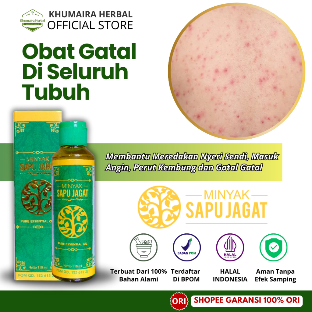 Jual Obat Gatal di Seluruh Tubuh, Gatal Bintik Bintik Merah, Penghilang ...