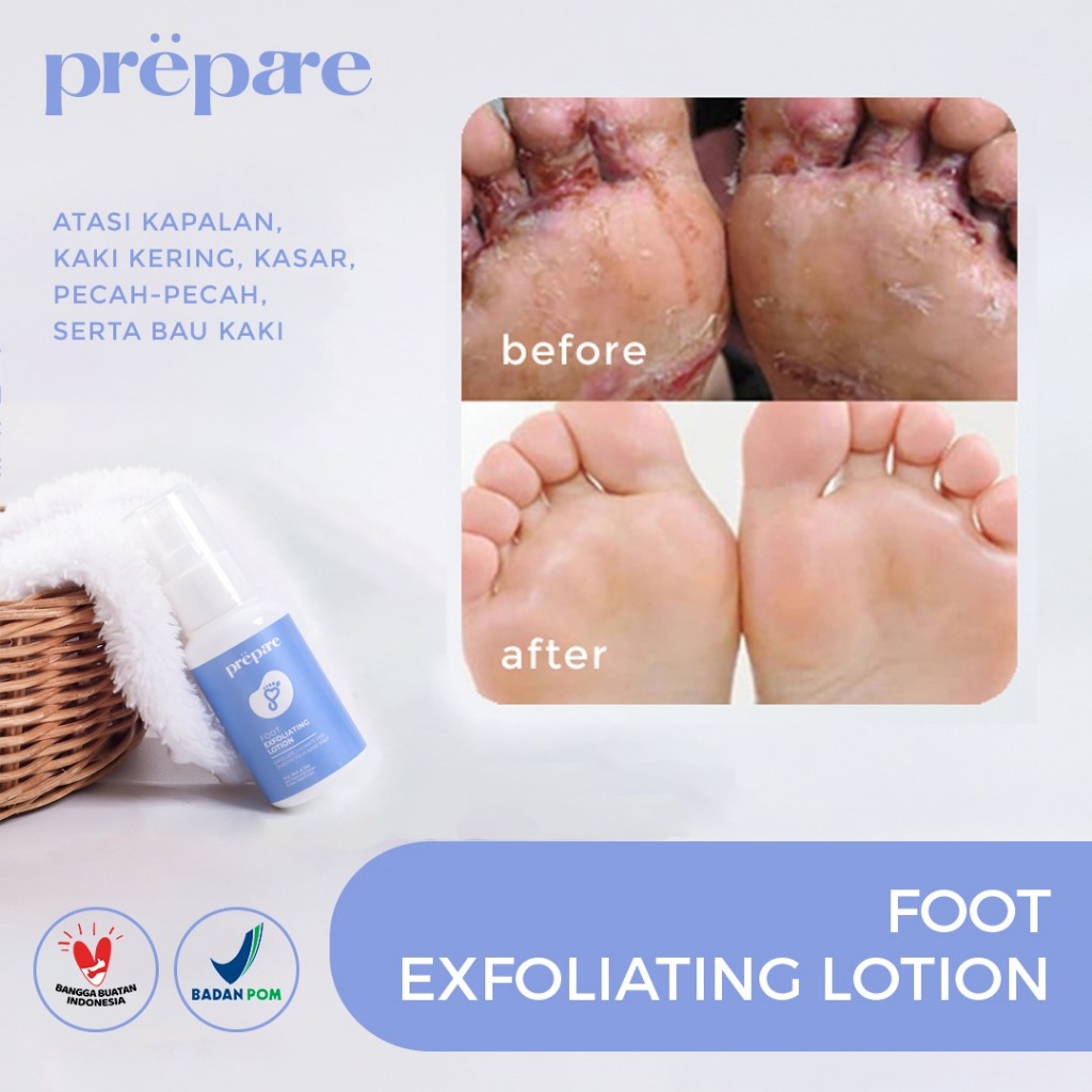 Jual PREPARE Penghalus Tumit Kaki Obat Kaki Pecah dan Kering Obat ...
