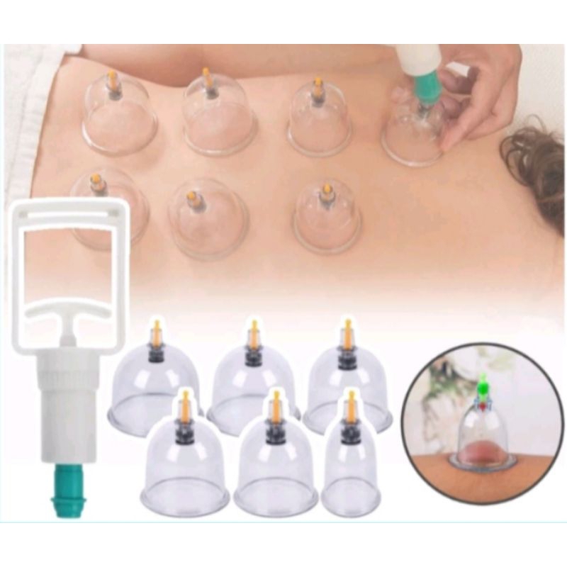 Jual alat bekam kop angin isi 6 pcs kepala tabung cup isap untuk masuk angin refleksi kerik ...