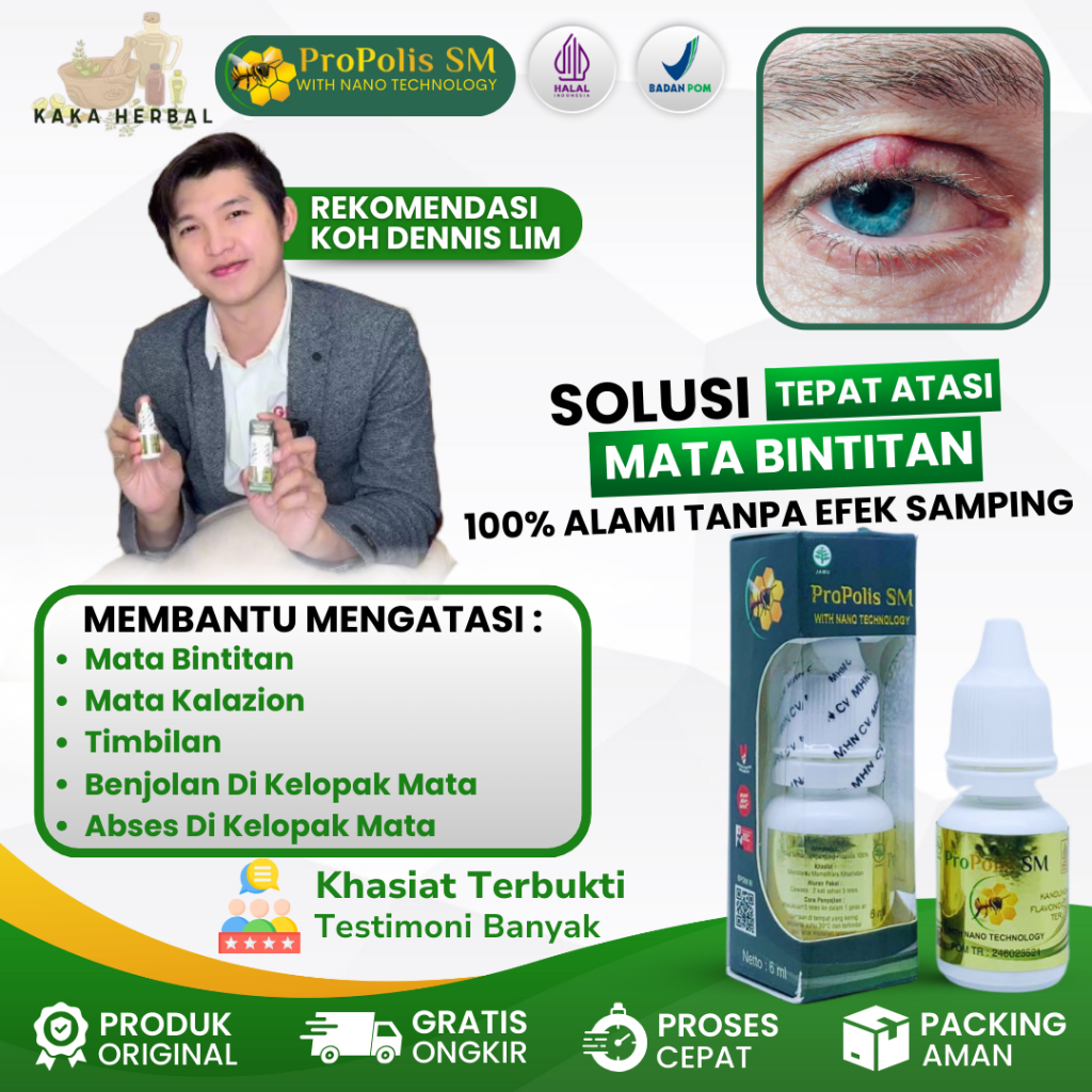 Jual Obat Mata Bintitan, Obat Mata Kalazion, Obat Benjolan Di Kelopak ...