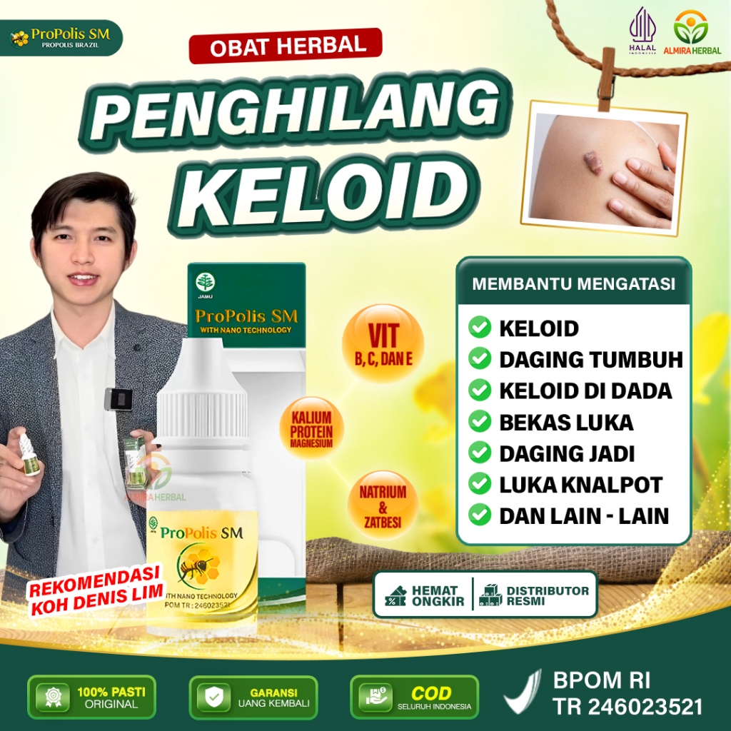Jual Obat Penghilang Keloid, Daging Tumbuh, Daging Jadi, Luka Tindik, Bekas Operasi Caesar ...