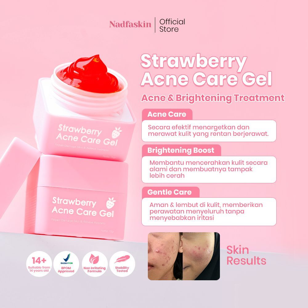 Jual [NEW LAUNCHING] Strawberry Acne Care Gel "Nadfaskin" | Shopee ...