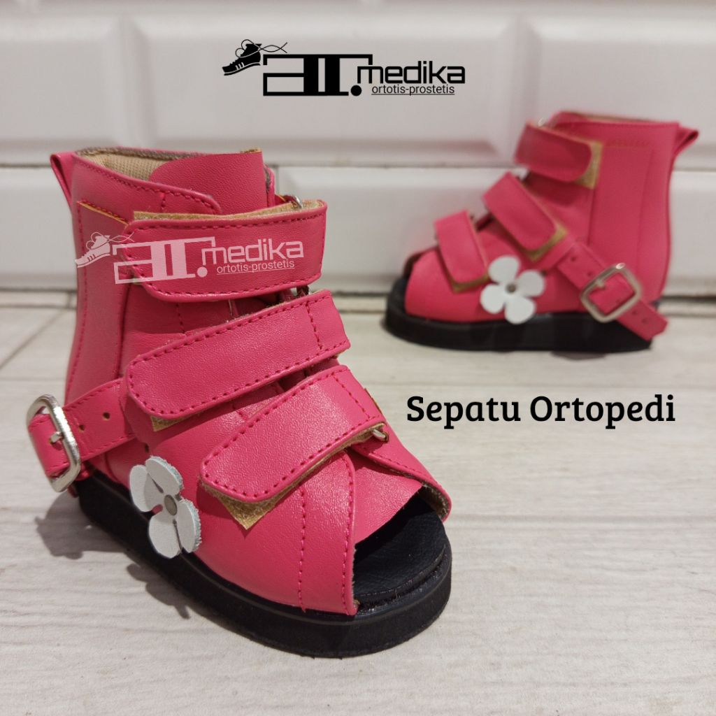 Jual Sepatu Orthopedic Koreksi Kaki Datar / Flat Foot, Bengkok, Jinjit ...