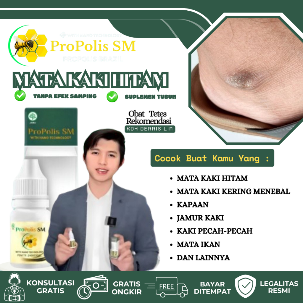 Jual Obat Tetes Mata Kaki Hitam, Obat Pemutih Mata Kaki Hitam, Obat ...