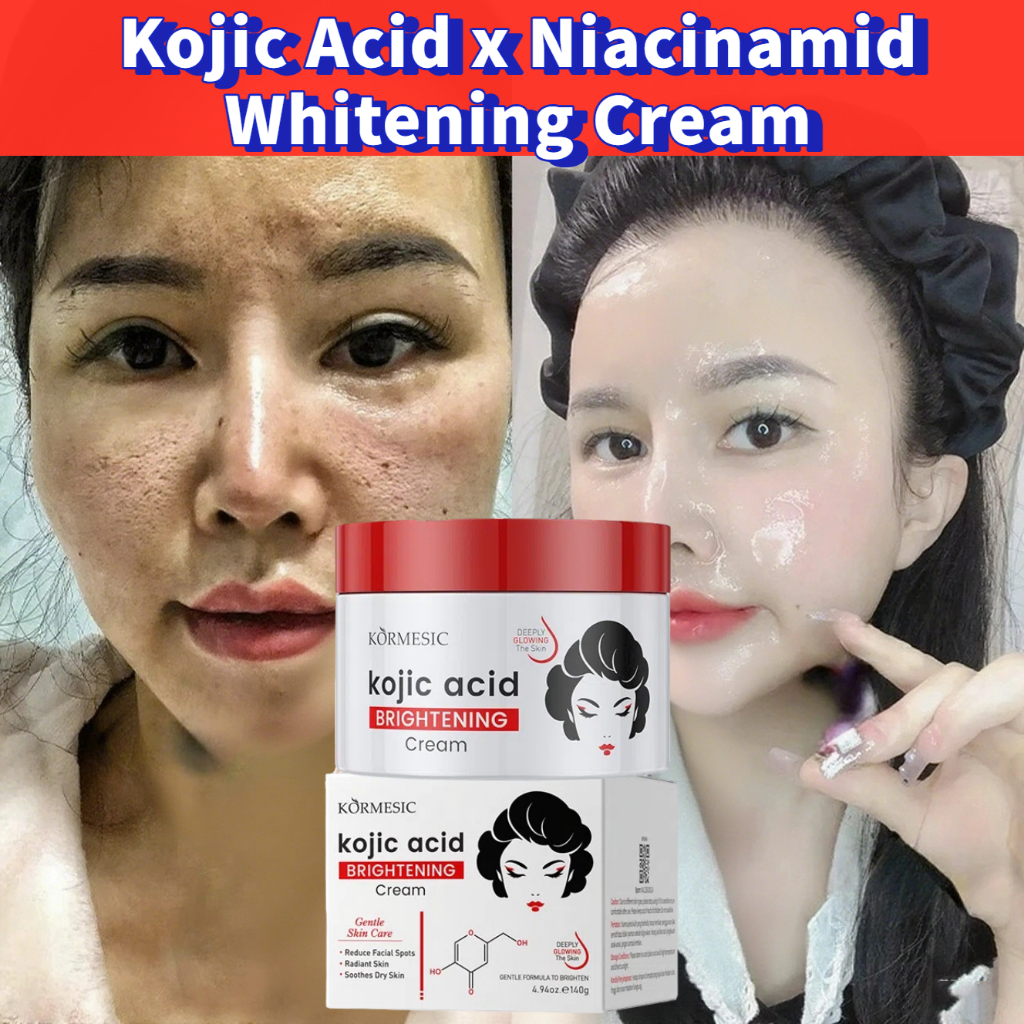 Jual [BPOM] KORMESIC Kojic Acid Facial Moisturizer Whitening Cream ...