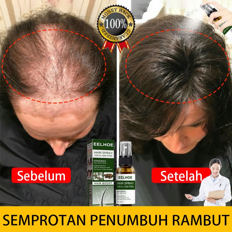Jual Hair serum rambut rontok Obat penumbuh rambut Semprotan penumbuh ...