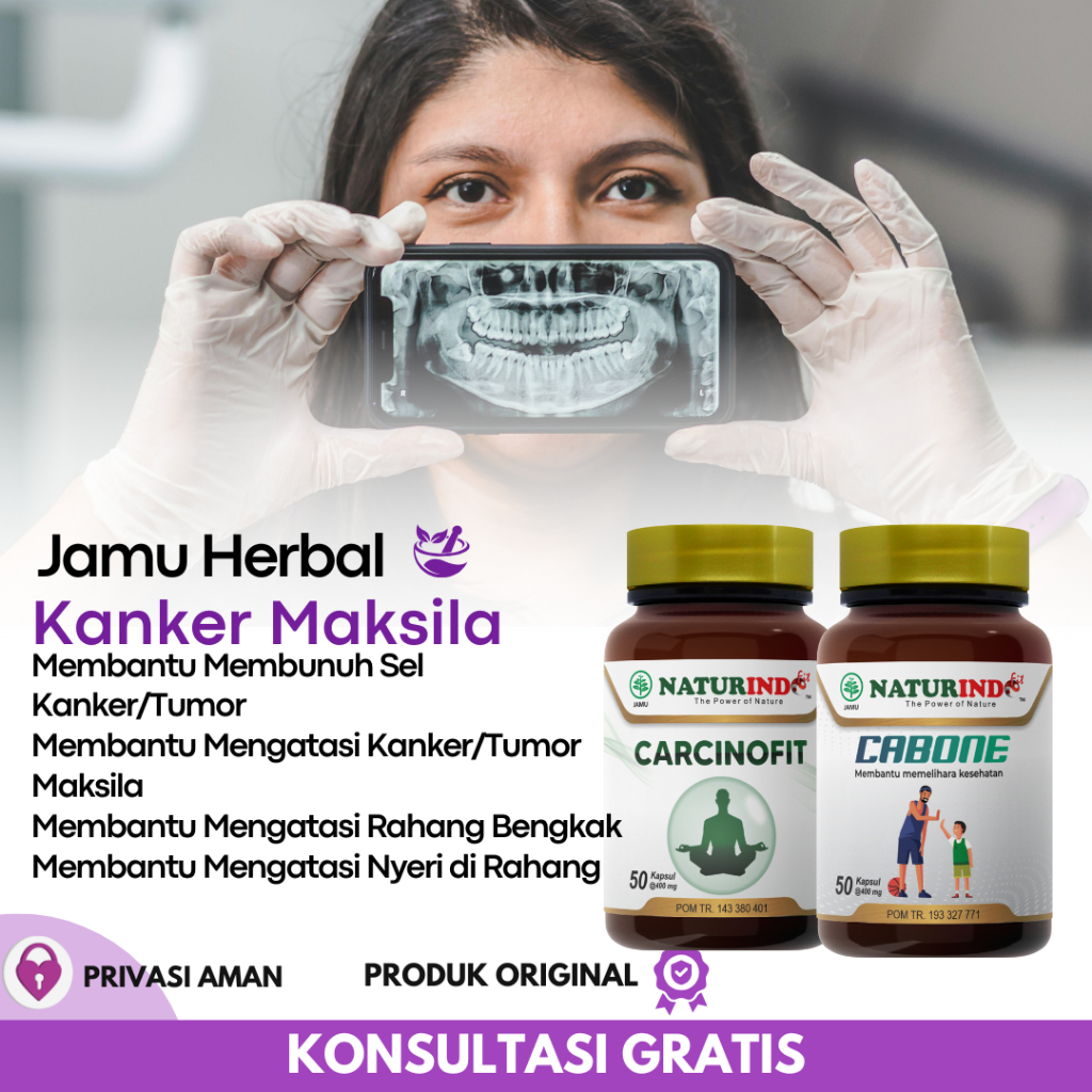 Jual Obat Herbal Kanker Rahang Maksila Bengkak Atas Kista Retensi Sinus ...