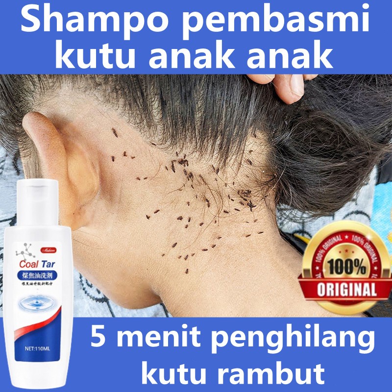 Jual Shampoo kutu rambut Shampo pembasmi kutu anak anak Penghilang kutu ...