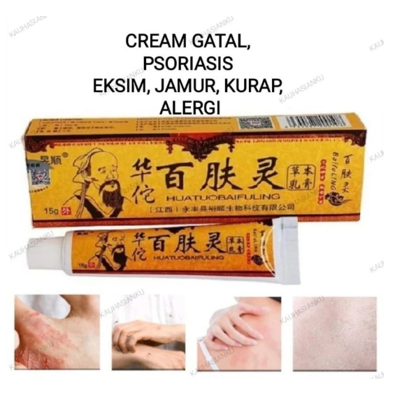 Jual SALEP CREAM HUATUOBAIFULING SALEP GATEL KULIT ALERGI 100% ORIGINAL ...