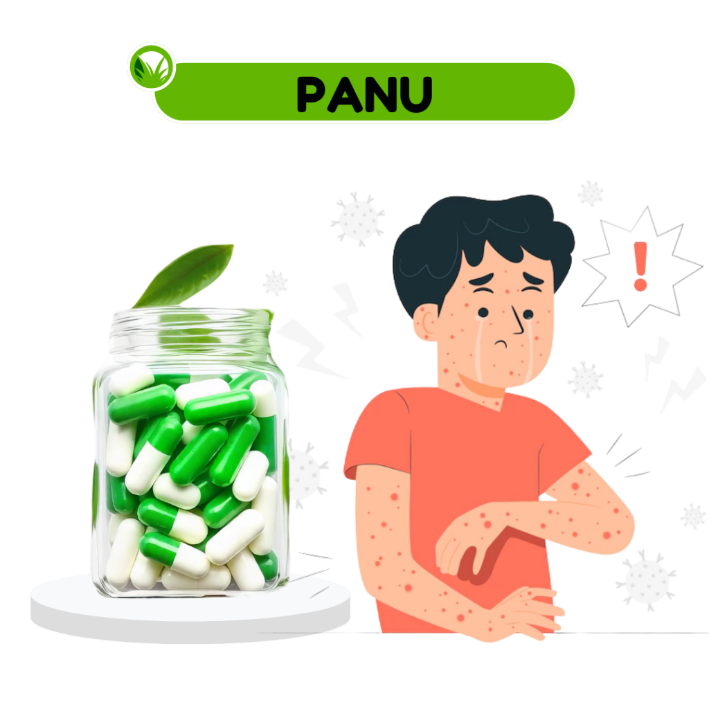 Jual Tablet Herbal Buat Gejala Panu Sakit Kepala Pegal Sakit Gigi ...