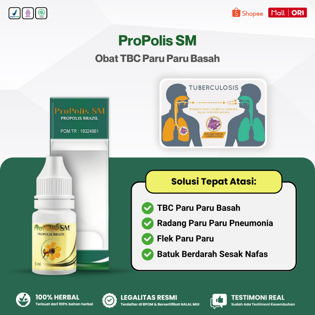 Jual Propolis SM - Obat TBC Paru Paru Basah Pneumonia Flek Paru Paru ...