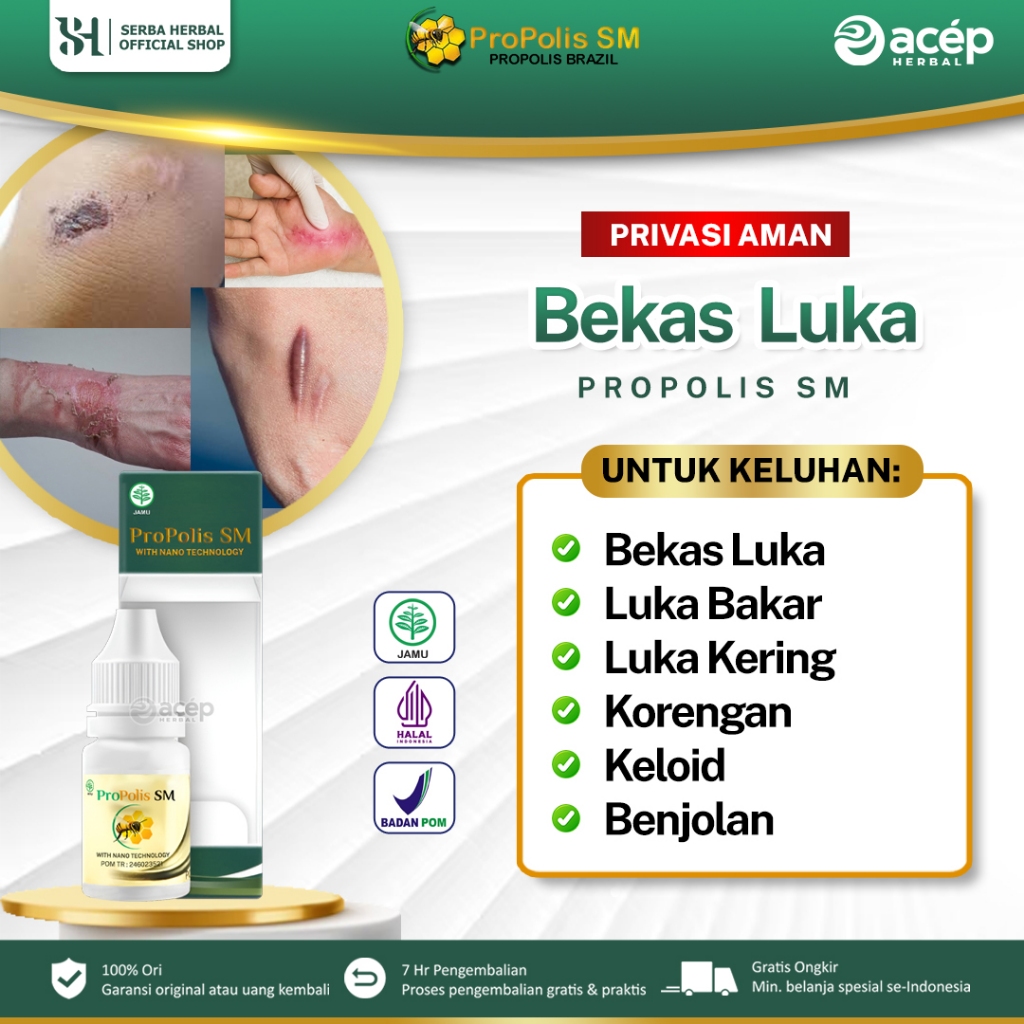Jual Obat Luka Bekas Gigitan Kutu Alergi Scabies Bintik Merah Kaligata ...