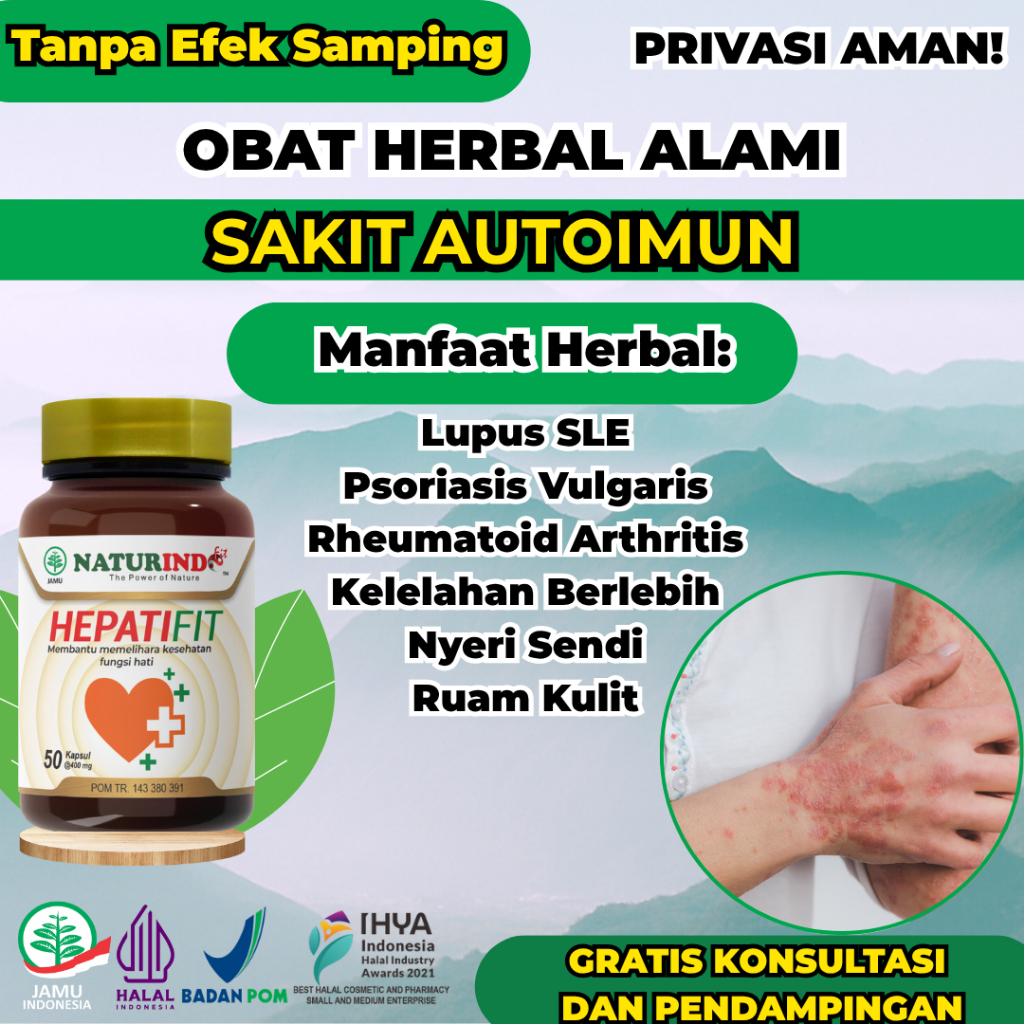 Jual Naturindo Hepatifit Obat Autoimun Lupus SLE Psoriasis Nyeri Sendi ...