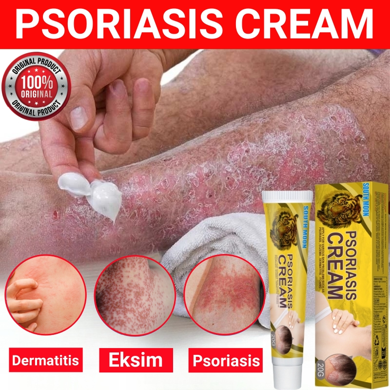Jual Salep Obat Gatal Psoriasis Cream Obat Eksim Paling Ampuh Herbal ...