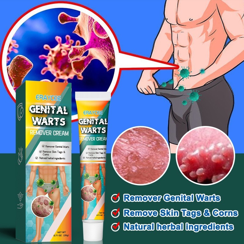 Jual Salep Kutil Kelamin HPV Obat Penghilang - Untuk Pria dan Wanita ...