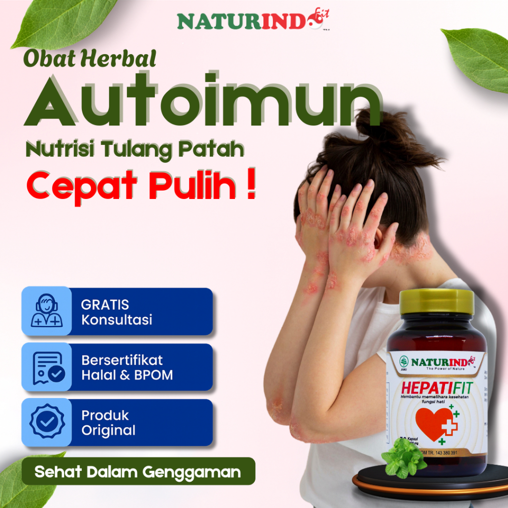 Jual Obat Autoimun Lupus Psoriasis Nyeri Radang Sendi Gatal Biduran ...