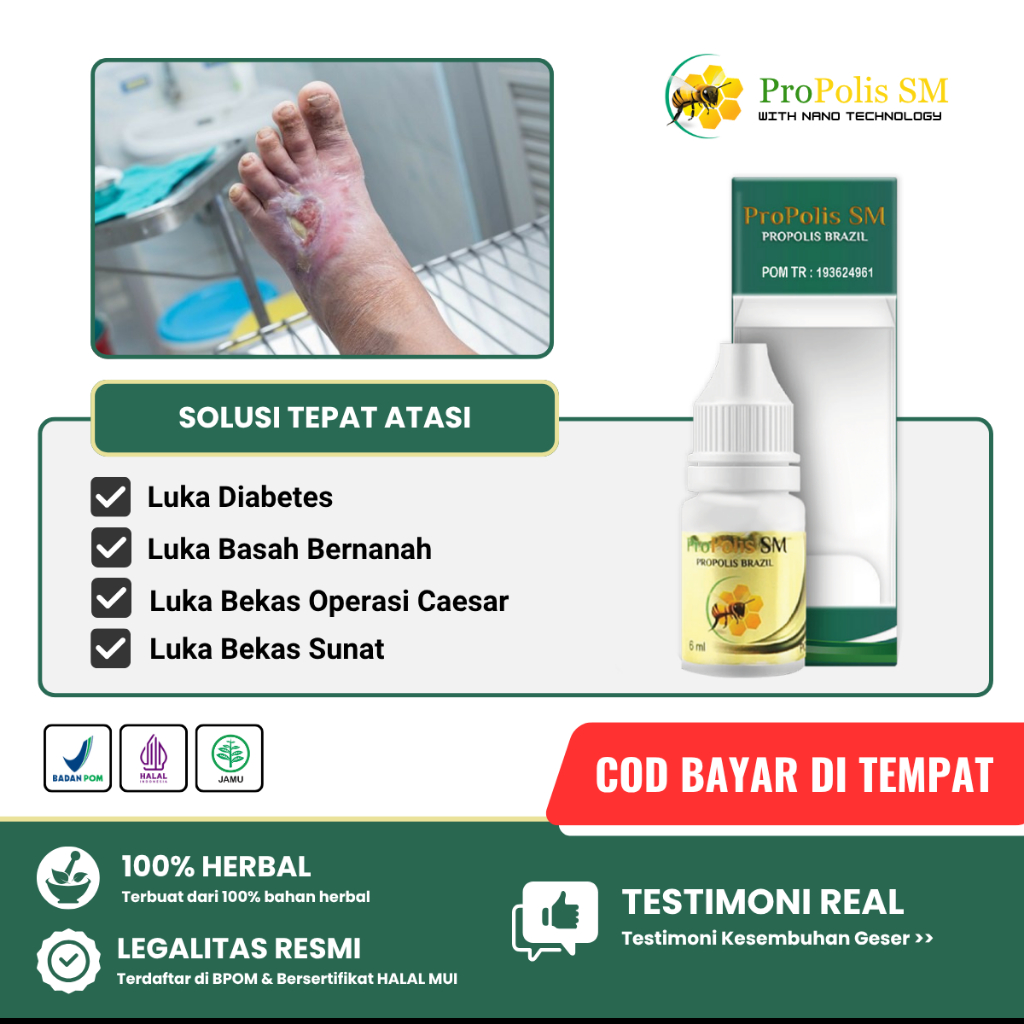 Jual Obat Luka Diabetes Basah Bernanah, Pengering Luka Diabetes ...
