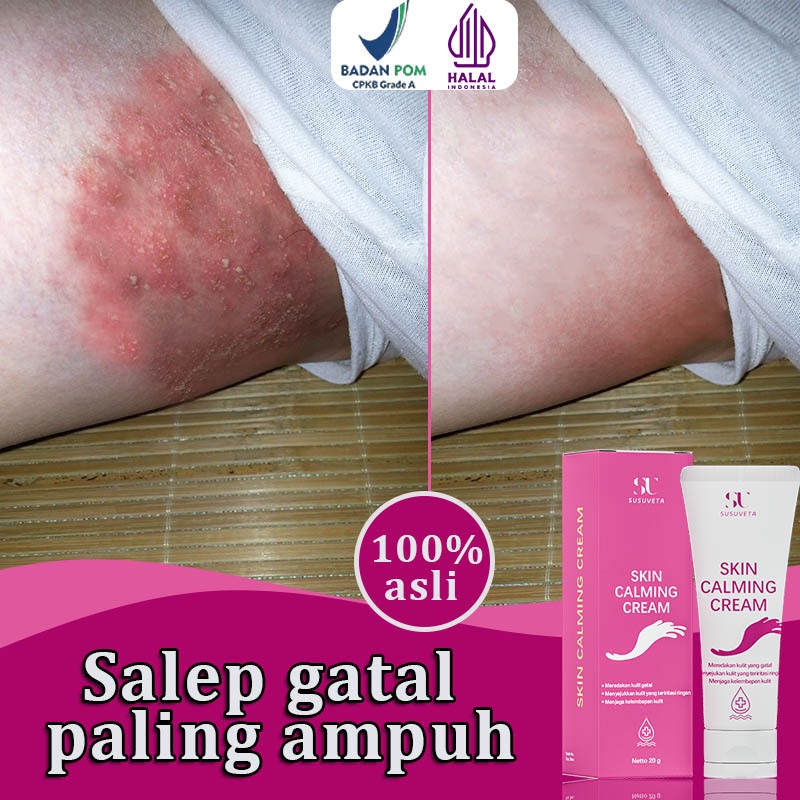 Jual Salep gatal selangkangan salep gatel salep gatal china paling ...