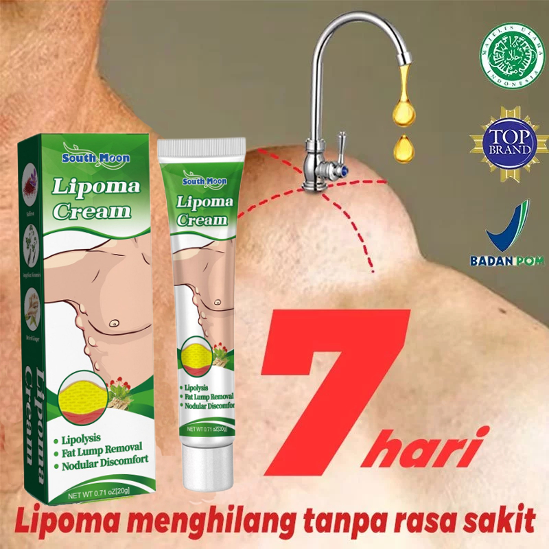 Jual Lipoma Cream 20g Benjolan Lemak salep lipoma salep benjolan Obat ...