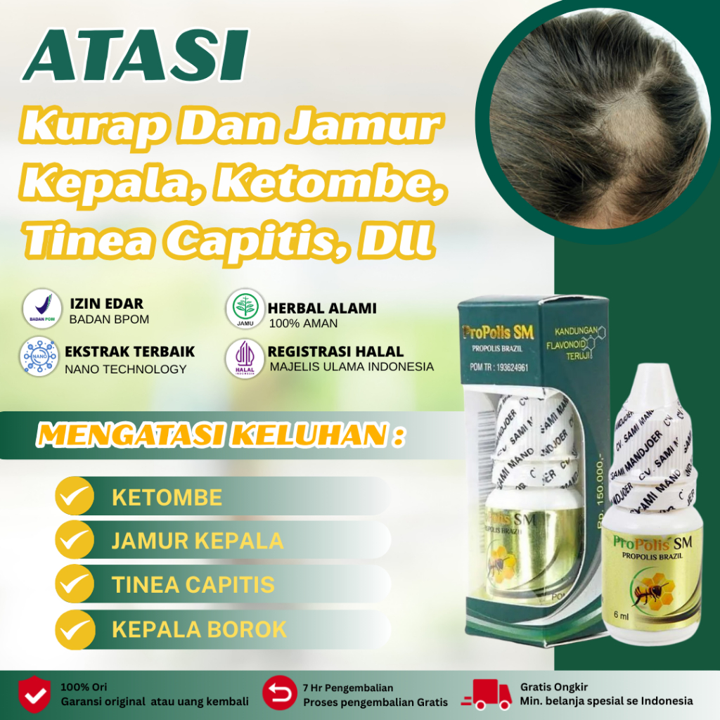 Jual Obat Oles Jamur Di Kulit Kepala, Kepala Berjamur, Gatal, Kulit ...