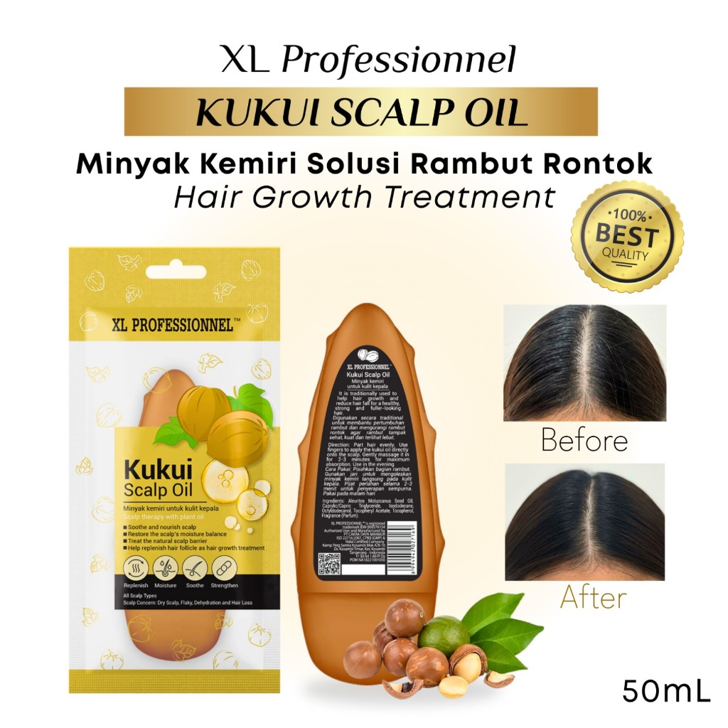 Jual [SOLUSI RONTOK] XL Professionnel Kukui Scalp Oil | Minyak Kemiri ...