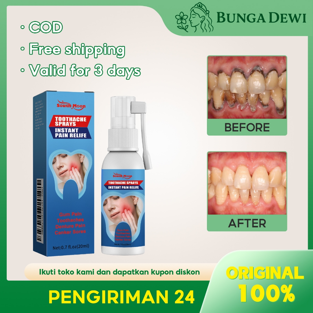 Jual 【Beli 3 Gratis 2/COD/ORI】South Moon Obat Sakit Gigi Berlubang ...