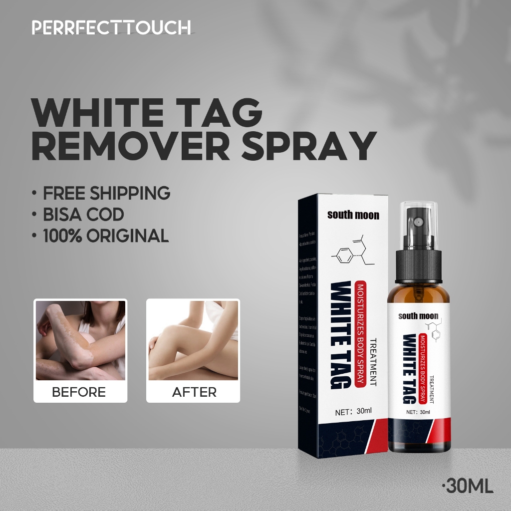 Jual South Moon White Tag Remover Spray 30ml Obat Vitiligo Reduces ...