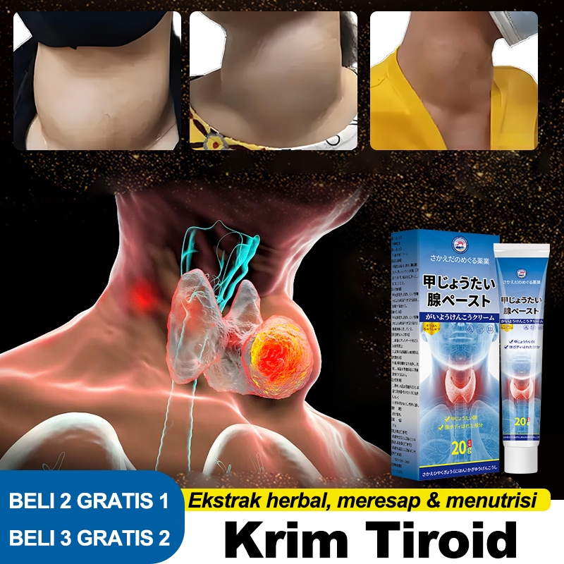 Jual Obat gondok Krim tiroid Benjolan di leher 20g kista tiroid ...