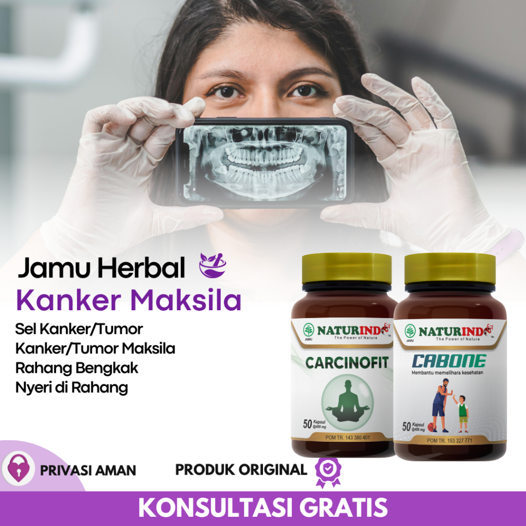 Jual Obat Herbal Kanker Rahang Maksila Bengkak Atas Kista Retensi Sinus ...
