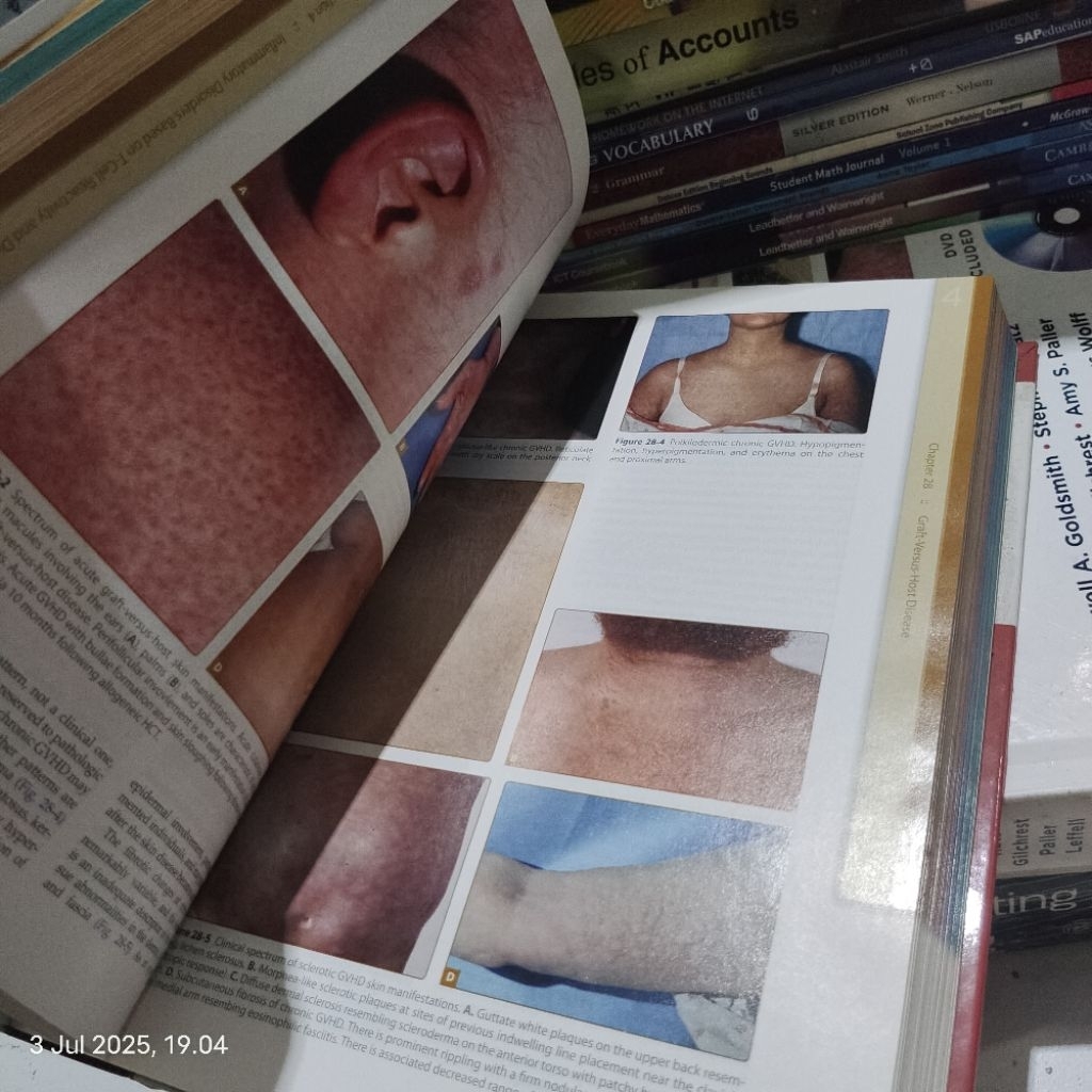 Jual BUKU FITZPATRICK'S DERMATOLOGY IN GENERAL MEDICINE EIGHTH EDITION ...