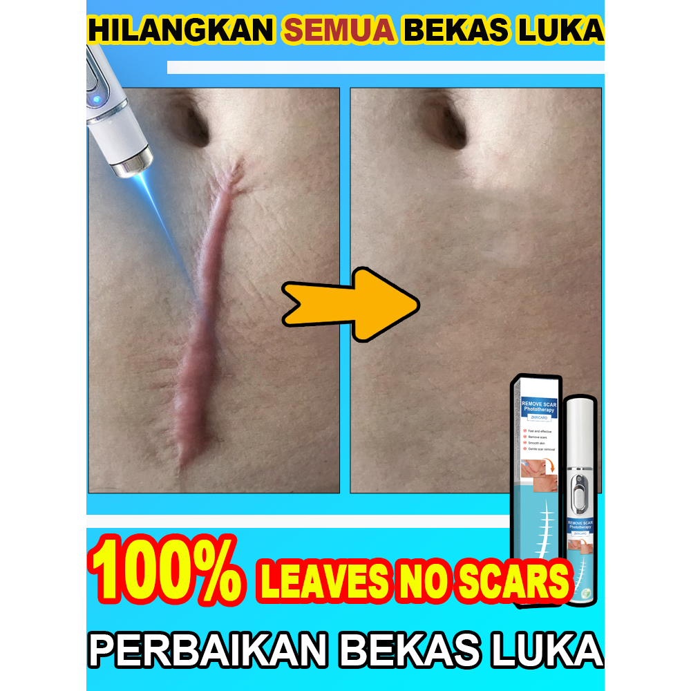 Jual Pena penghilang bekas luka laser, menghilangkan bekas luka ...